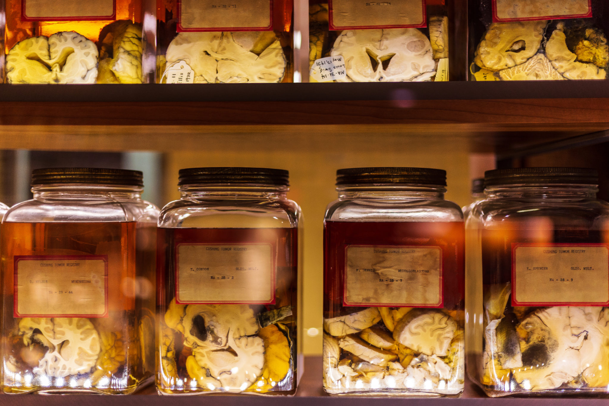 INSIGHT: Mind on the brain | Yale Daily News